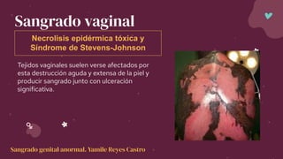 Sangrado Genital Anormal, ginecología clínica | PDF