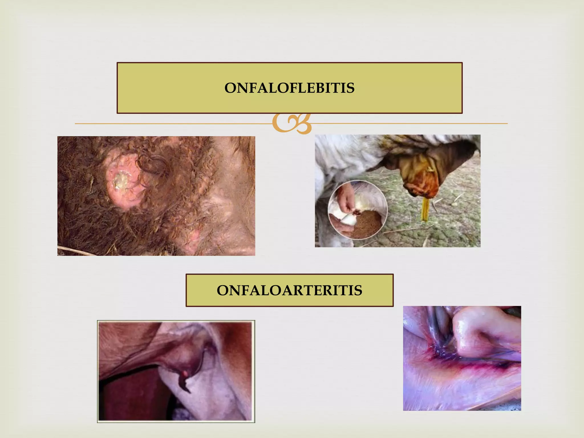 ONFALITIS-ONFALOFLEBITIS-ONFALOARTERITIS | PDF