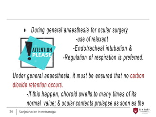 sanjnaharan in netraroga anesthesia in ophthalmology | PPT