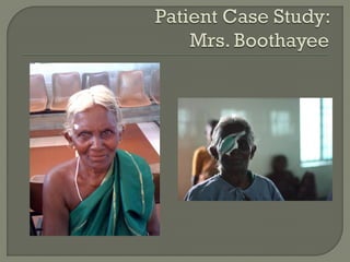 Sankara Eye Camp - A model rural outreach program | PDF