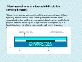 Formulation and evaluation of transdermal drug delivery system (TDDS) | PPT