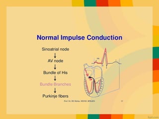 SINOATRIAL NODE | PPTX
