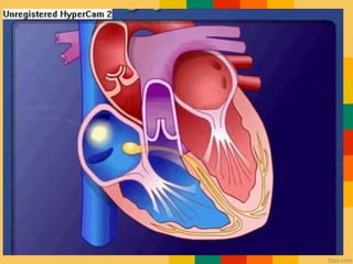 SINOATRIAL NODE | PPTX