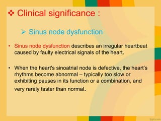 SINOATRIAL NODE | PPTX