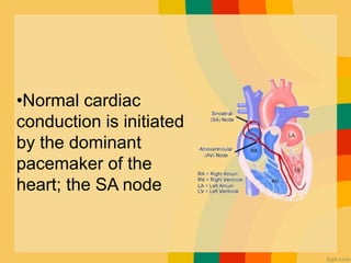 SINOATRIAL NODE | PPTX