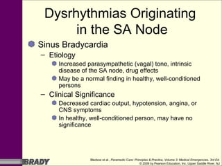 Sa node arrhythmias | PPT