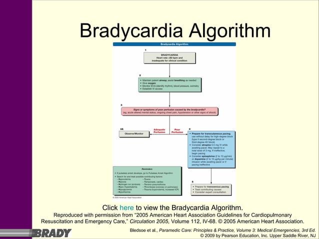 Sa node arrhythmias | PPT