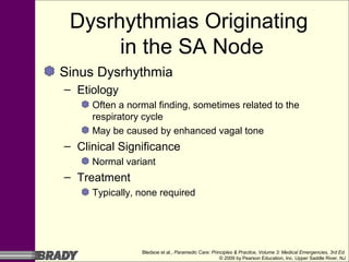 Sa node arrhythmias | PPT