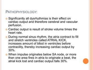 SA Node Dysrhythmia | PPTX
