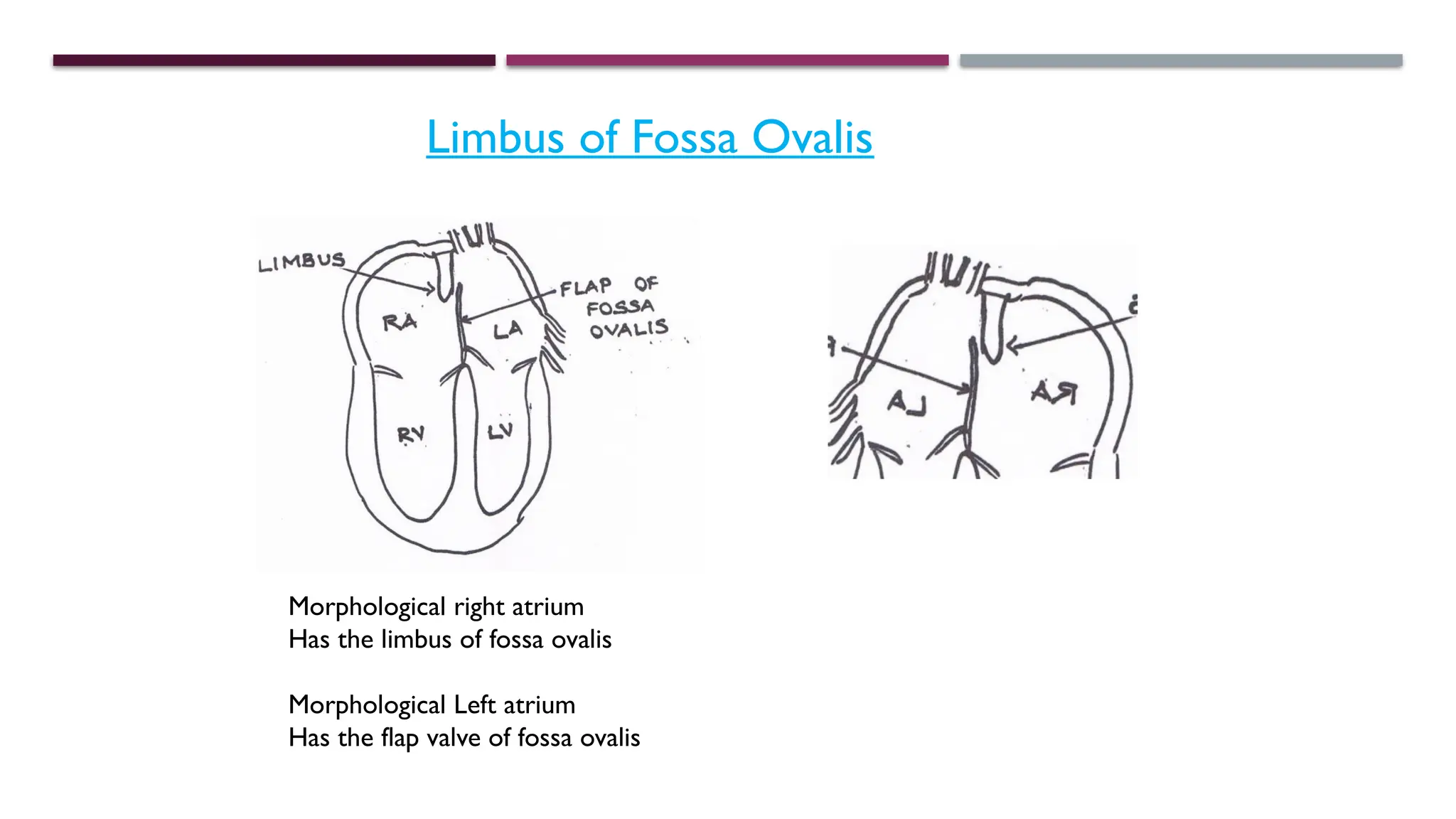 SEGMENTAL ANALYSIS of cardiac defects ppt | PPTX