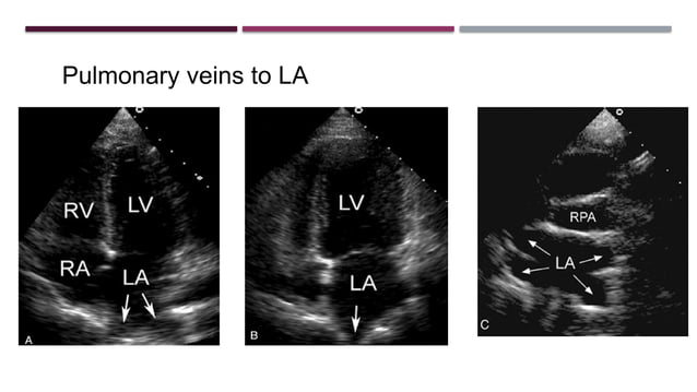 SEGMENTAL ANALYSIS of cardiac defects ppt | PPTX | Heart and ...