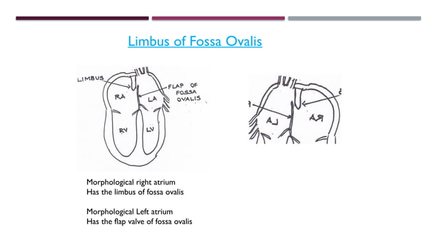SEGMENTAL ANALYSIS of cardiac defects ppt | PPTX | Heart and ...