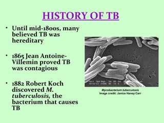 EPIDEMIOLOGY OF TUBERCULOSIS | PPT