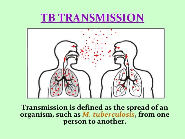 EPIDEMIOLOGY OF TUBERCULOSIS