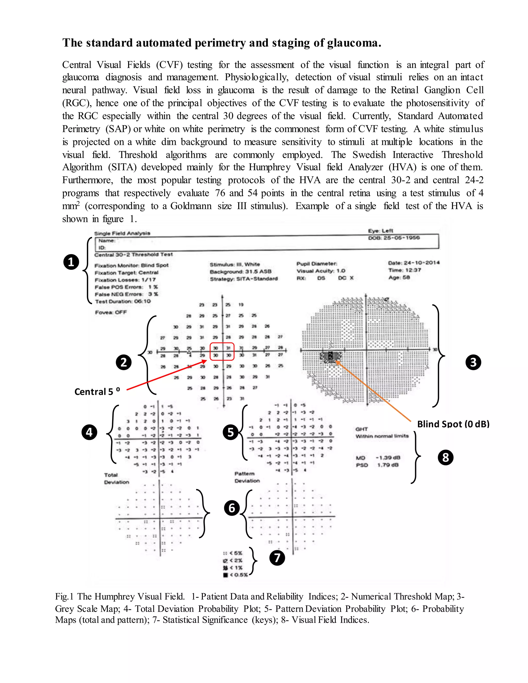 The standard Automated Perimetry and staging of Glaucoma | PDF