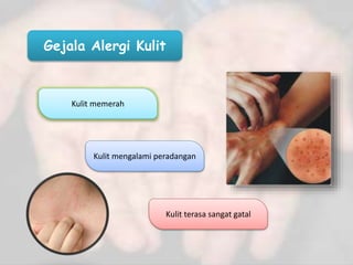 ppt Sap alergi kulit | PPTX