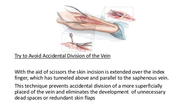 Saphenous Vein Harvesting