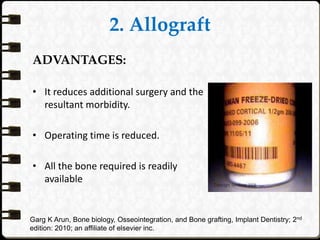 Bone grafts | PPTX