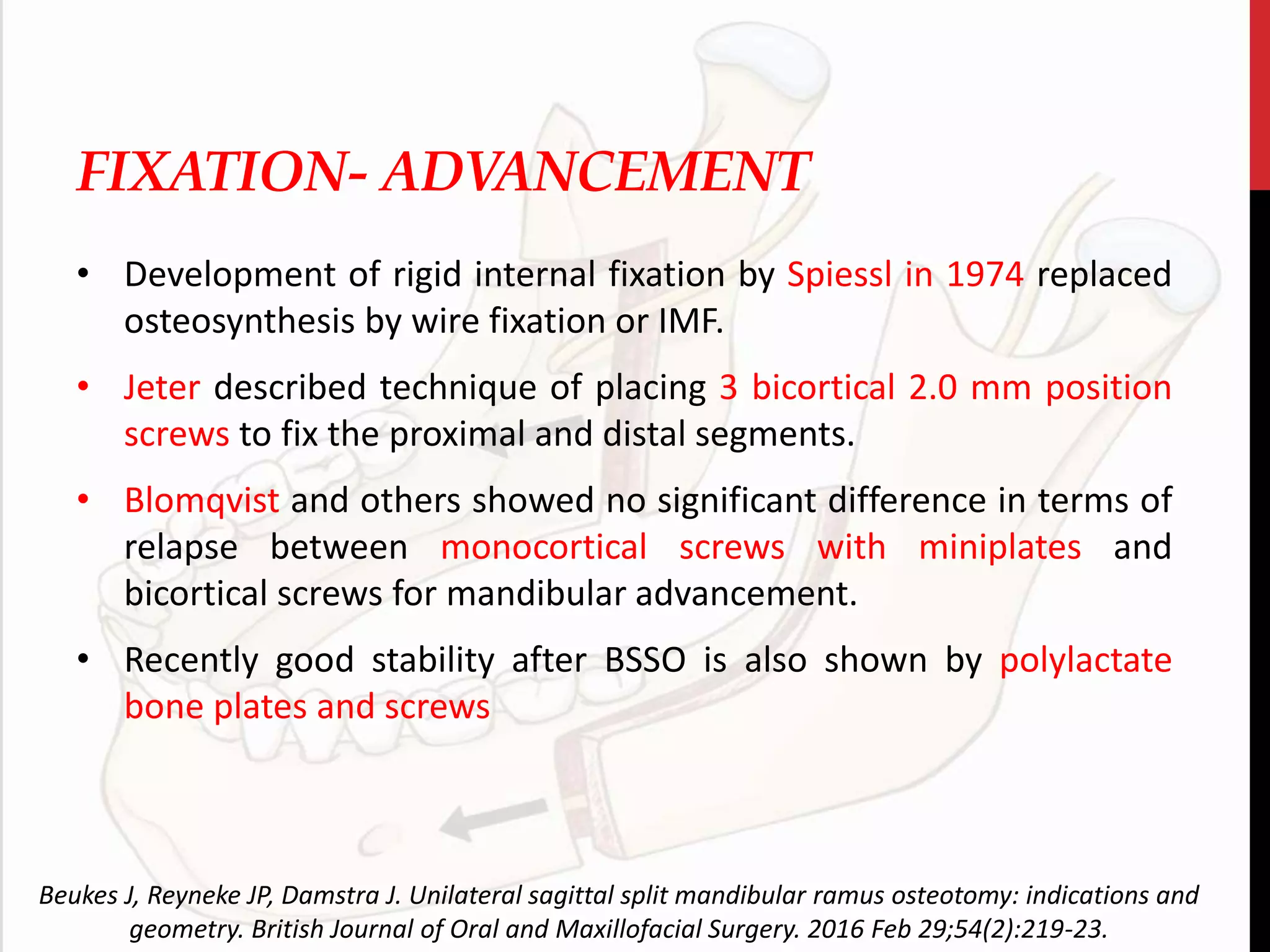 Mandibular osteotomies in orthognathic surgery of Face | PPTX