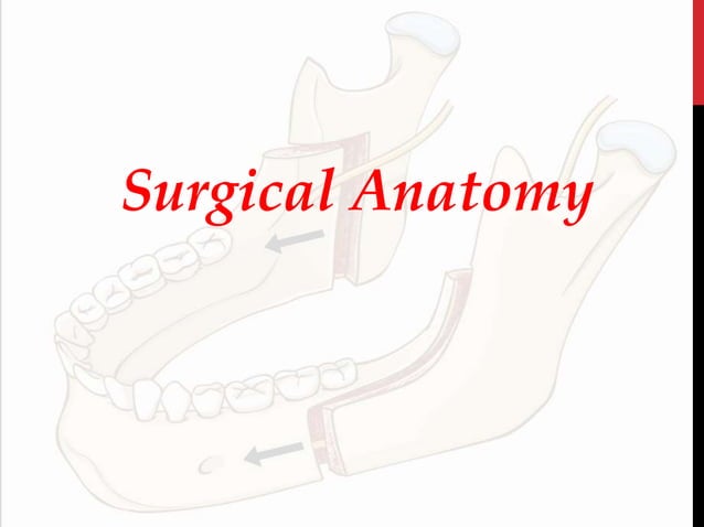 Mandibular osteotomies in orthognathic surgery of Face | PPTX