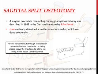 Mandibular osteotomies in orthognathic surgery of Face | PPTX