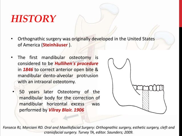 Mandibular osteotomies in orthognathic surgery of Face | PPTX