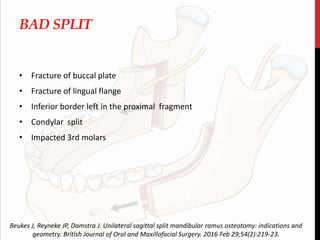 Mandibular osteotomies in orthognathic surgery of Face | PPTX