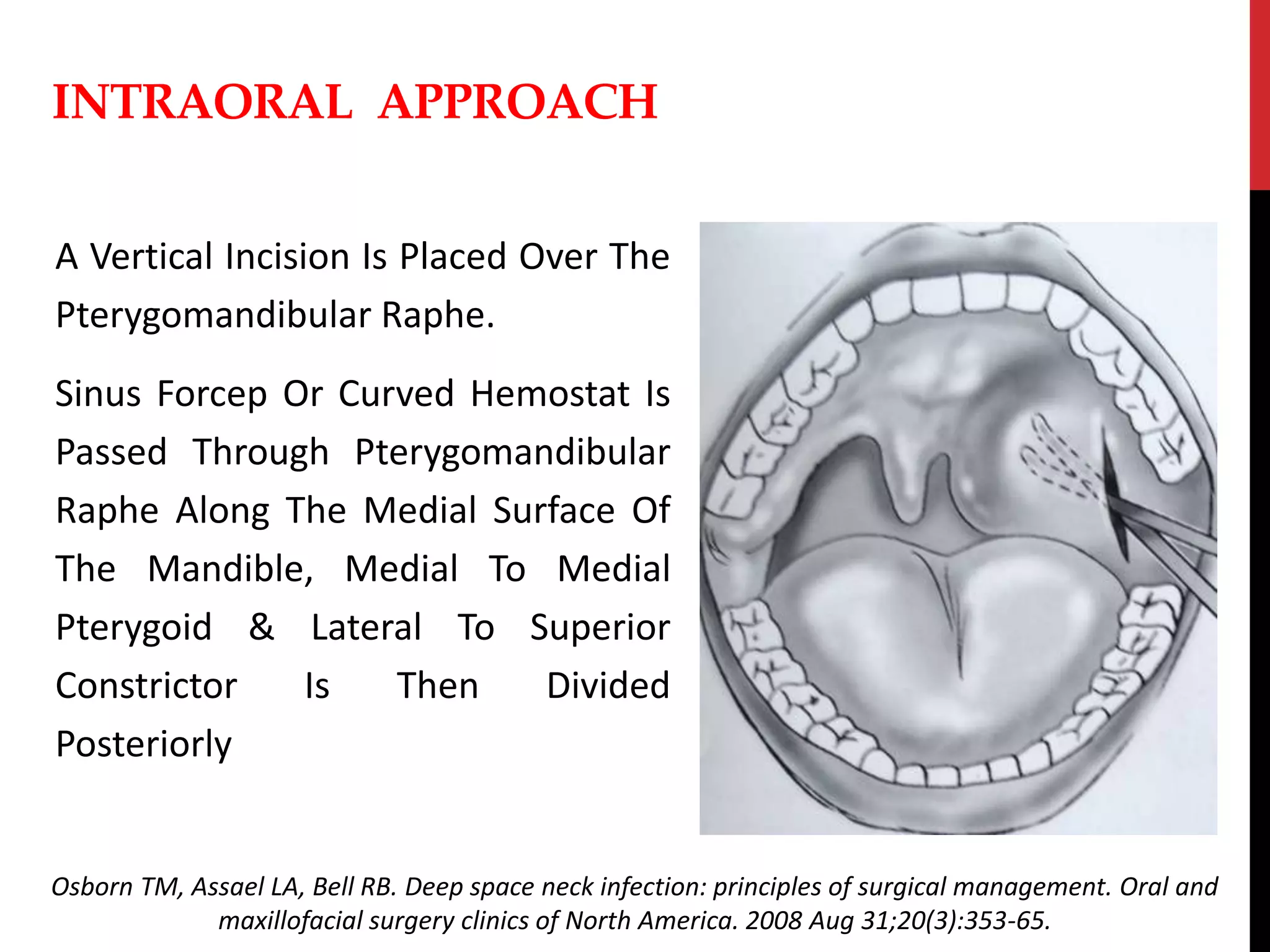 Deep space infections of Head and Neck | PPTX