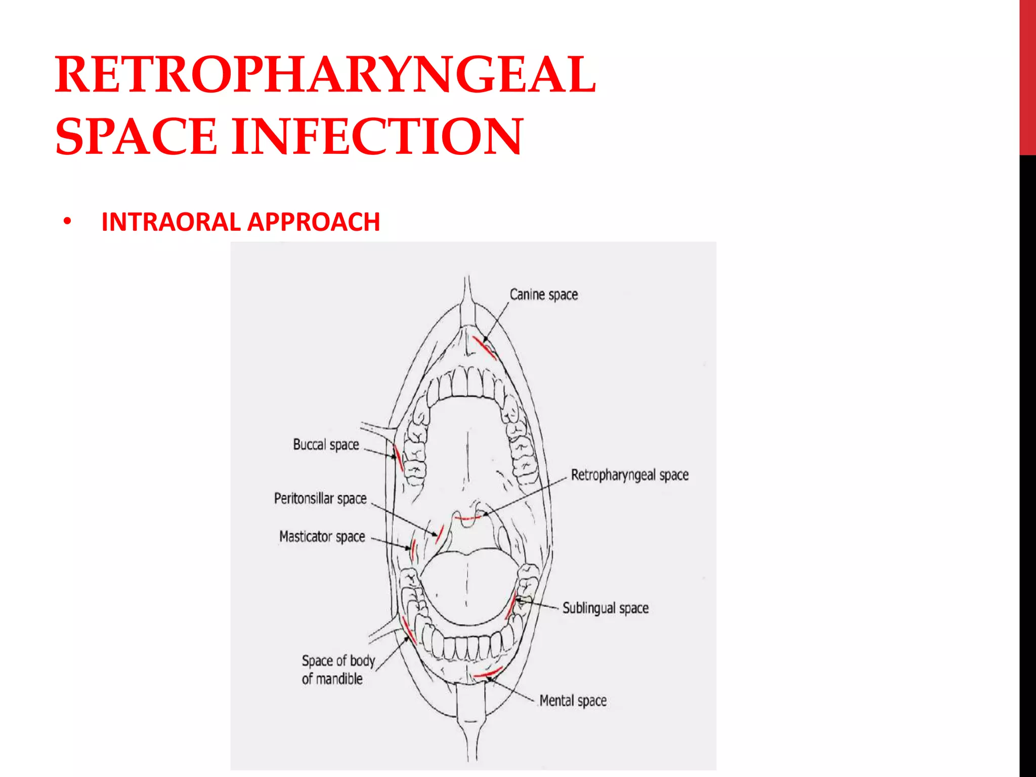 Deep space infections of Head and Neck | PPTX