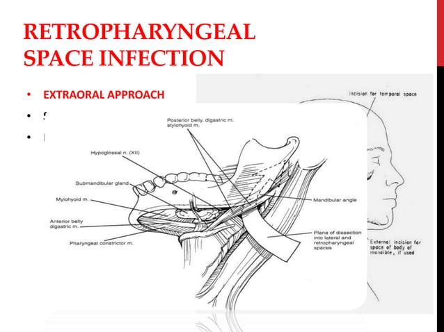 Deep space infections of Head and Neck | PPTX