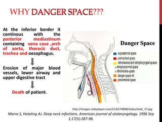 Deep space infections of Head and Neck | PPTX