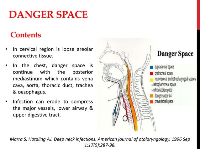 Deep space infections of Head and Neck | PPTX