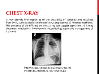 Deep space infections of Head and Neck | PPTX