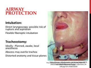 Deep space infections of Head and Neck | PPTX