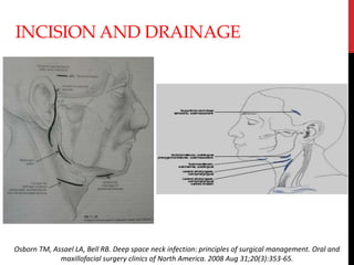 Deep space infections of Head and Neck | PPTX