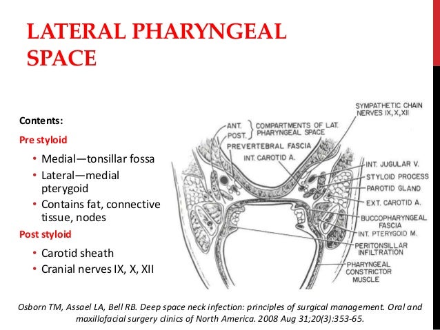 Lateral Pharyngeal Space Abscess