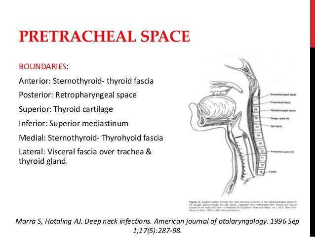 Deep space infections of Head and Neck