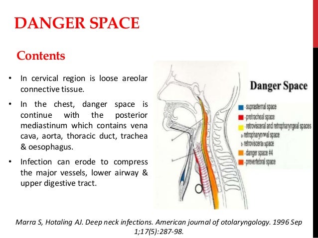 Deep space infections of Head and Neck