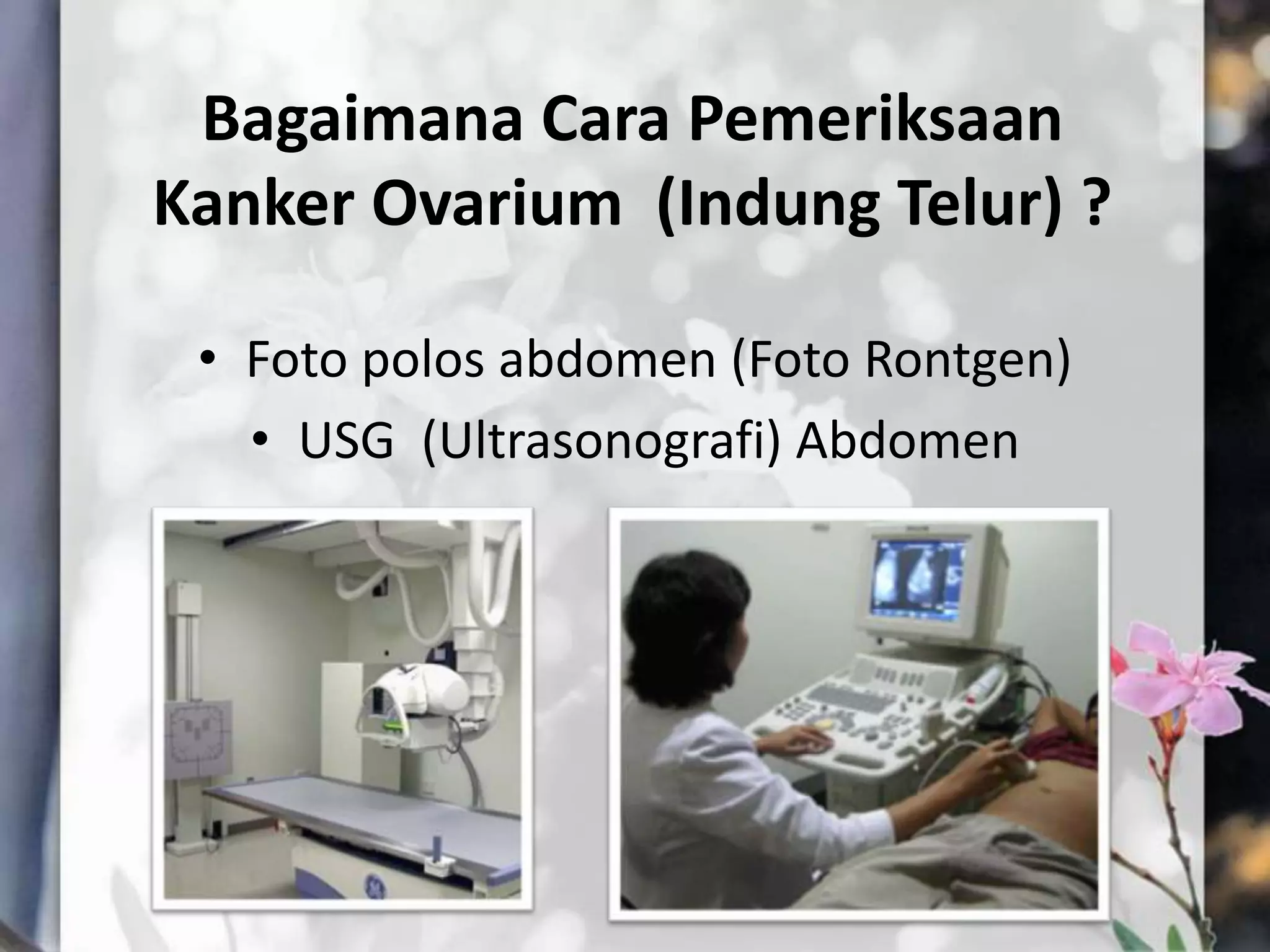 kanker ovarium | PPT