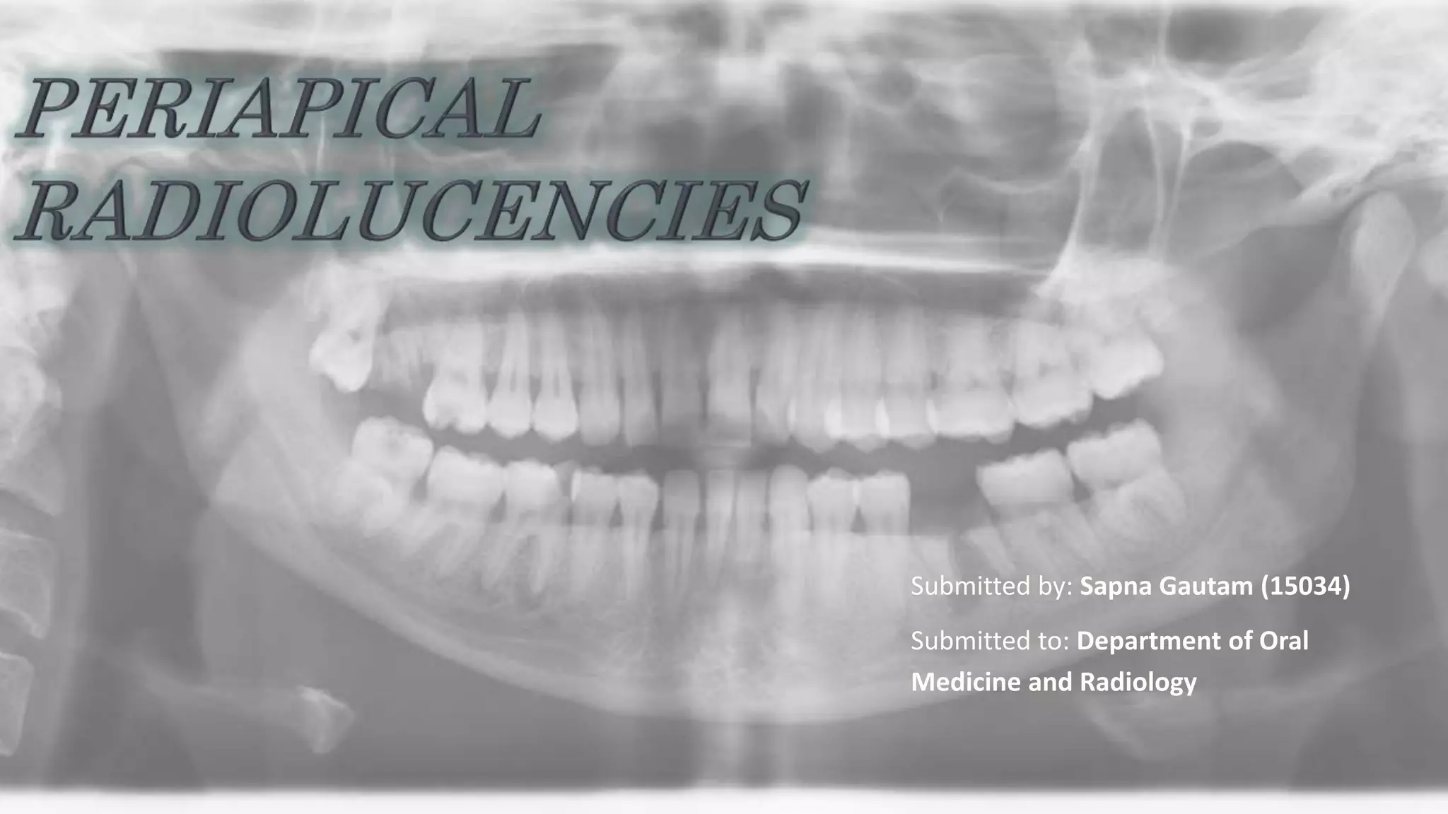 periapical radiolucencies | PPTX