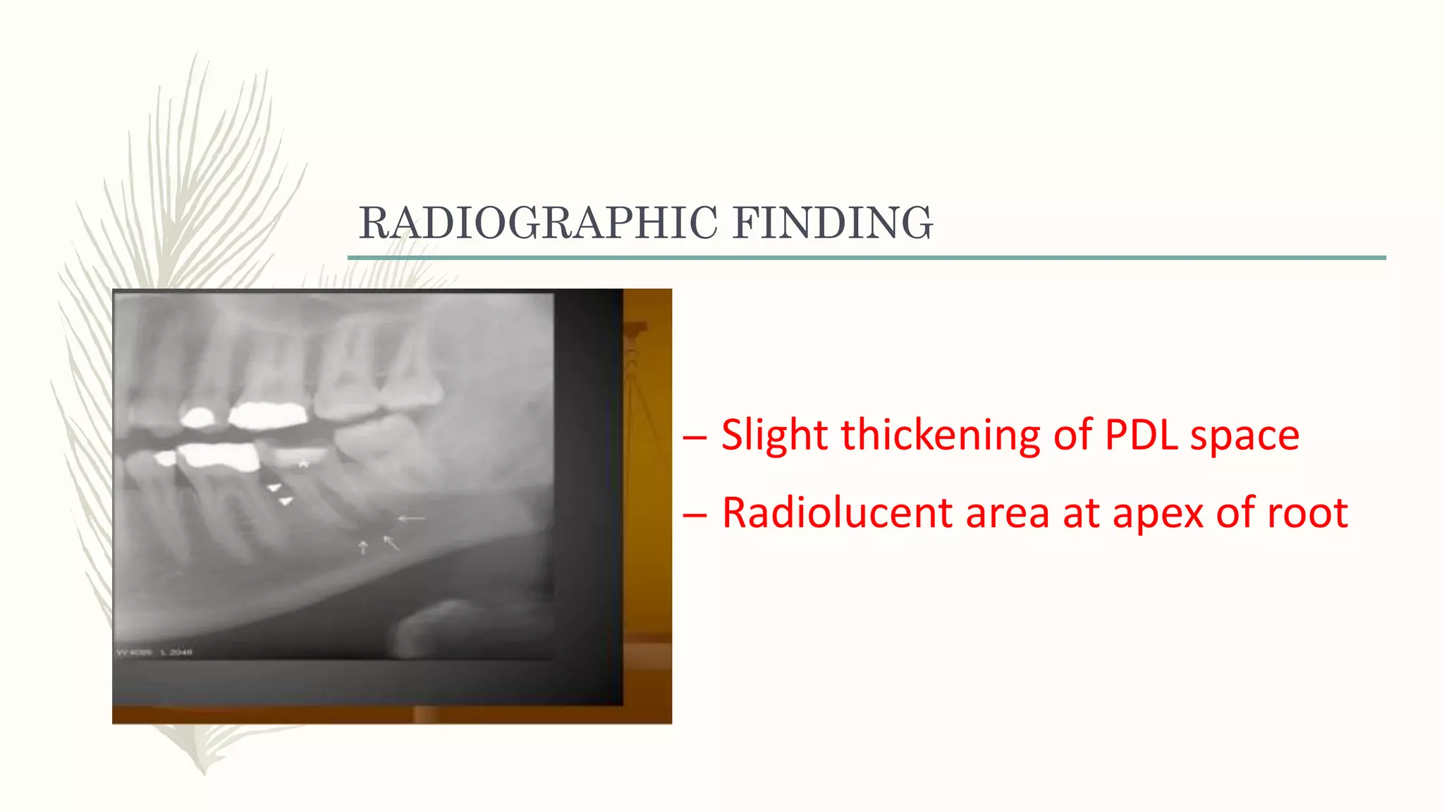 periapical radiolucencies | PPTX