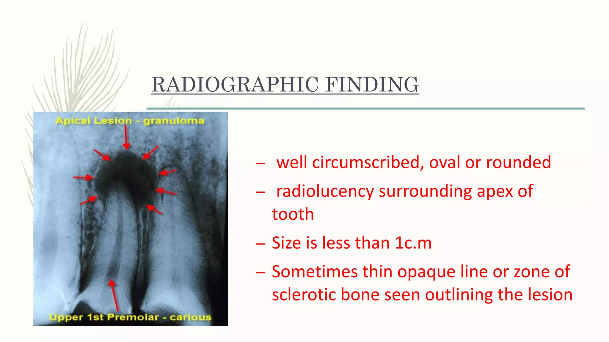 periapical radiolucencies | PPTX