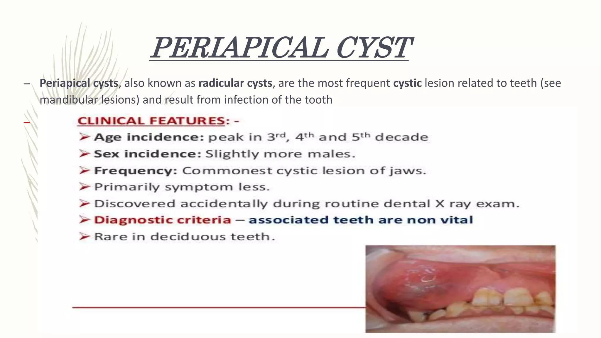 periapical radiolucencies | PPTX