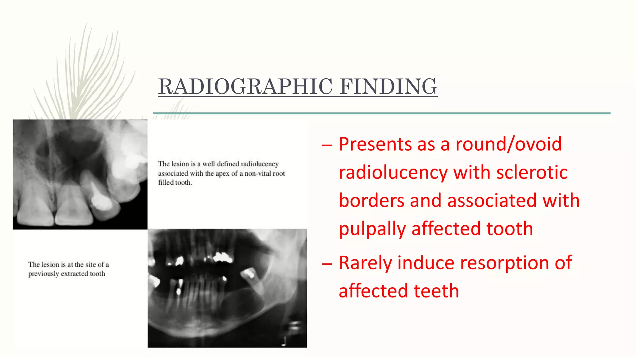 periapical radiolucencies | PPTX