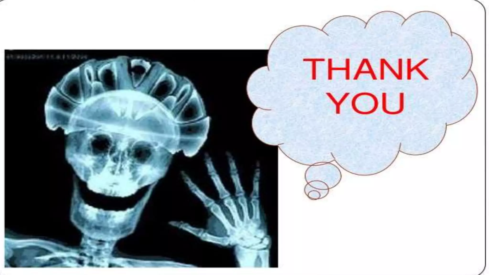 periapical radiolucencies | PPTX