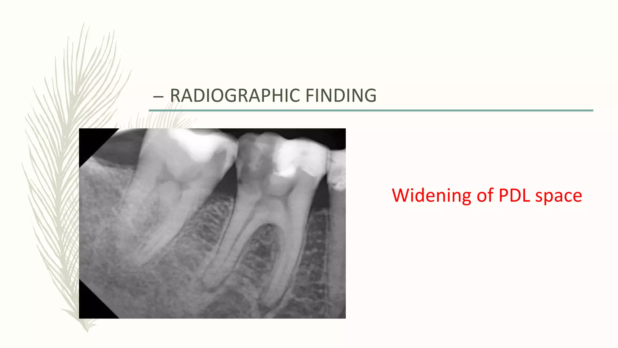periapical radiolucencies | PPTX