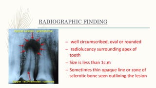 periapical radiolucencies | PPTX