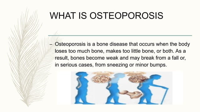 Osteoporosis | PPTX