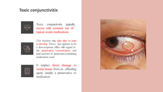 SARAH YASMIN R - PPT - CONJUNCTIVITIS.pptx