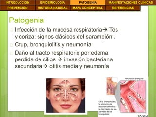 Sarampión | PPTX
